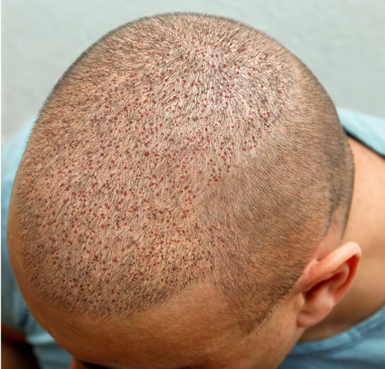 Nepal Skin Hospital - Leading Hospital for Skin Care